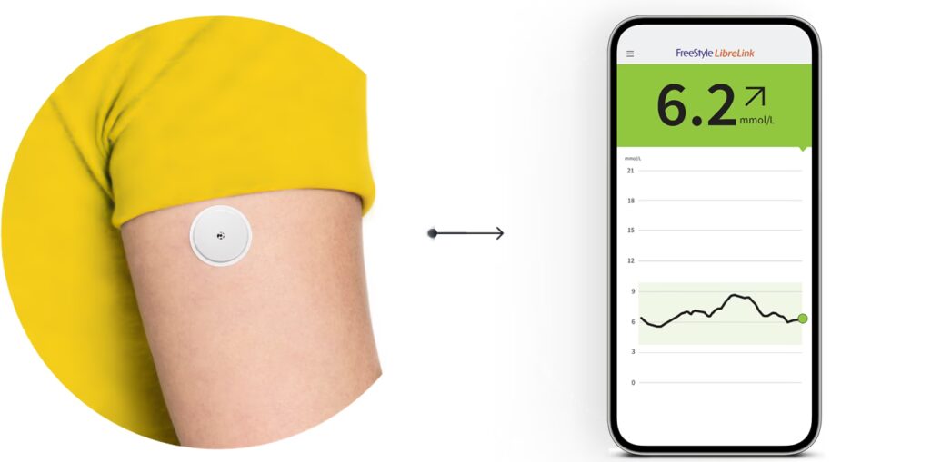 FreeStyle LibreLink en Chile: Innovación para el Control de la Diabetes ...